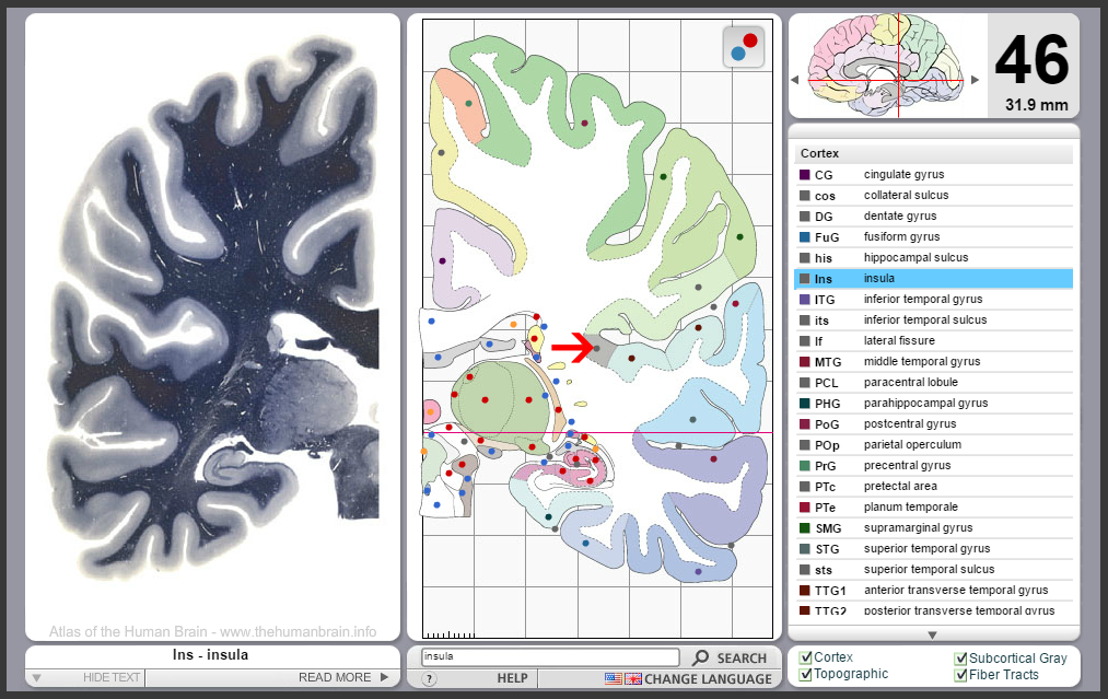 BRAIN-COMPUTER INTERFACES over EEG: Atlas Brain