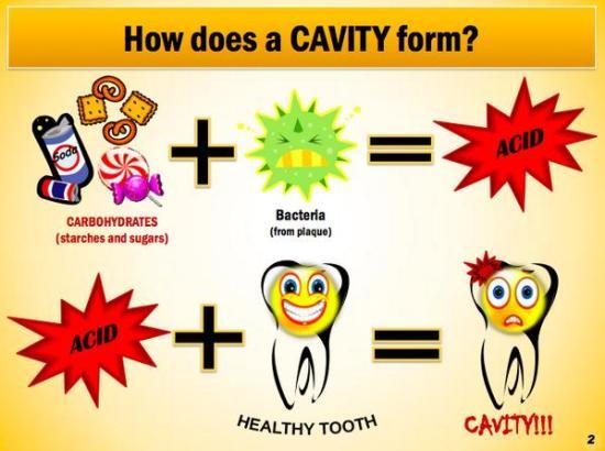 CAVITY!! what it is all about?