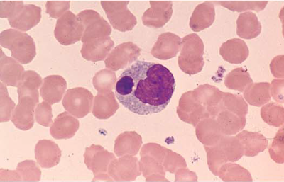 VETERINARY HEMATOLOGY DEXTERVET: Monocyte with phagocytized nuclear residue