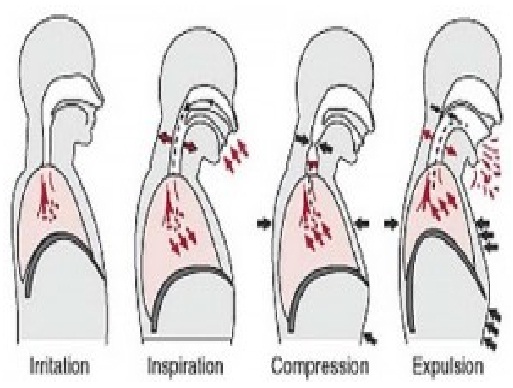 KEPERAWATAN PADA ANAK (AFIDA & RULY): MEKANISME TERJADINYA BATUK