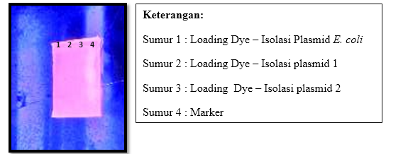 Isolasi DNA Plasmid dari Sel Inang E. coli yang Terinsert Enzim ...