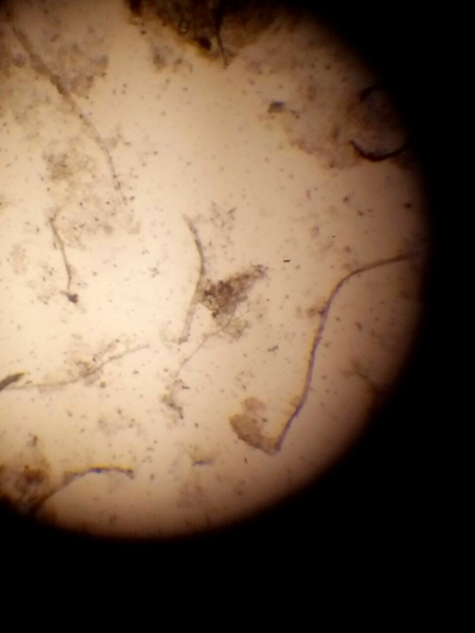 Biología Aplicada 4ºA-1-2014: Células animales: mucosa bucal