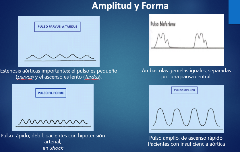 PULSO RESUMEN CON DIAPOSITIVAS ~ SOMMERLYSPDF Los Mejores Libros de ...