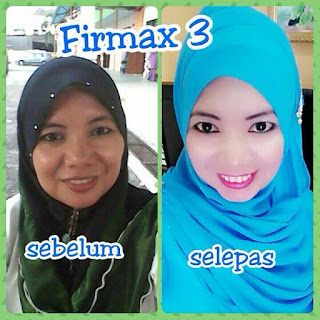 firmax3: Transformasi Wajah setelah menggunakan CREaM FIRmax3 + Serum ...