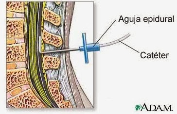 MAMÁS ENFERMERAS: PARTO CON EPIDURAL