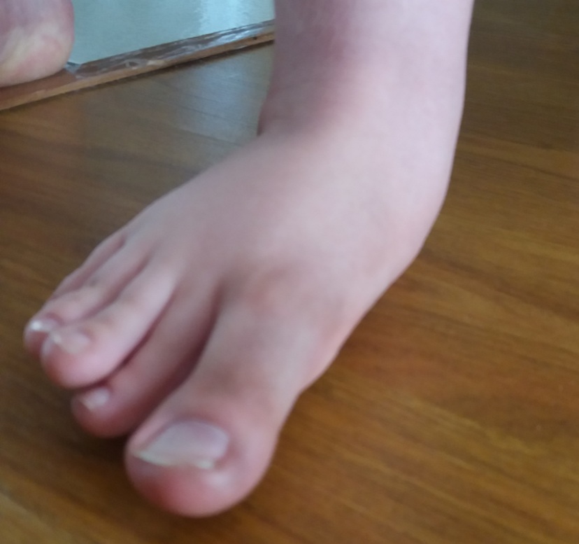 SAM...MORE THAN A CONQUEROR: TEETH, FEET AND A FIRST EVER SCHOOL ...