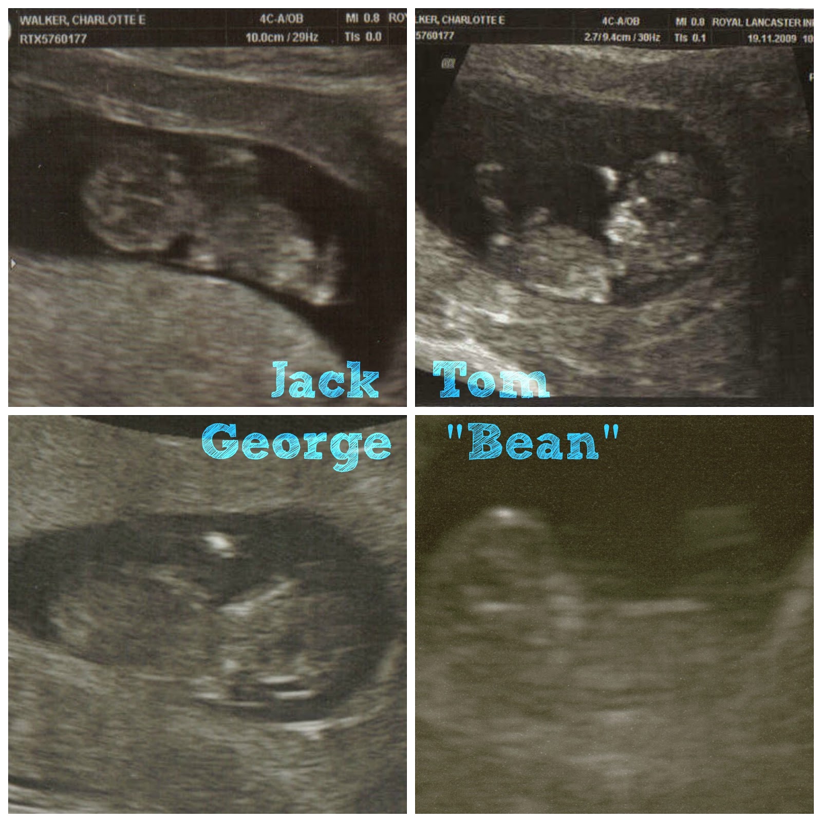 Mumma Walker's 7 Years of Pregnancy by CharlieBeth: Early Gender ...