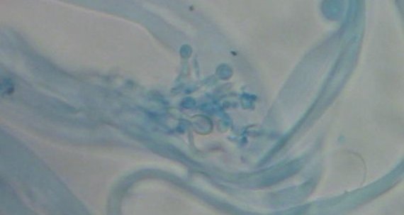 Microbiología y Epidemiología: Trichophyton rubrum. Trichophyton ...