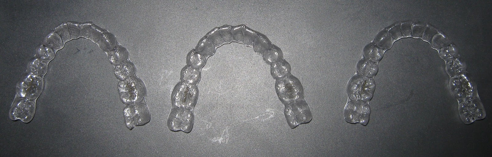 Br@ndy's Invisalign Journey: Tray 20!