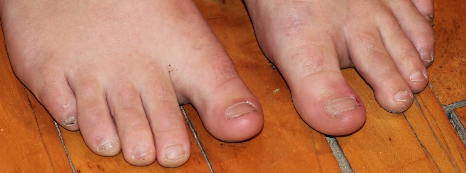 Houston Foot Specialists: Easy Ways to Strengthen Your Toes