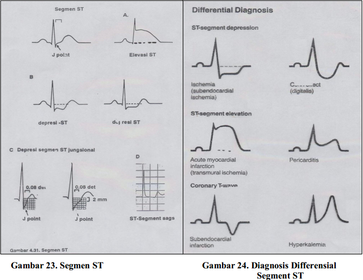 EKG dan Ilmu Dasarnya