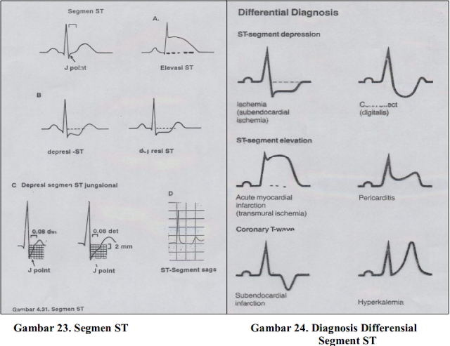EKG dan Ilmu Dasarnya