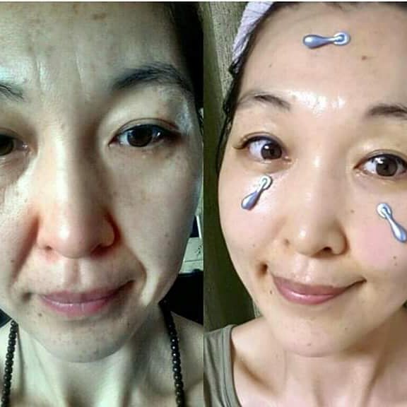 Mengapa Harus Nu Skin ??: Serum AgeLOC Tru Face Essence Ultra - Serum ...