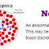 Neutropenia