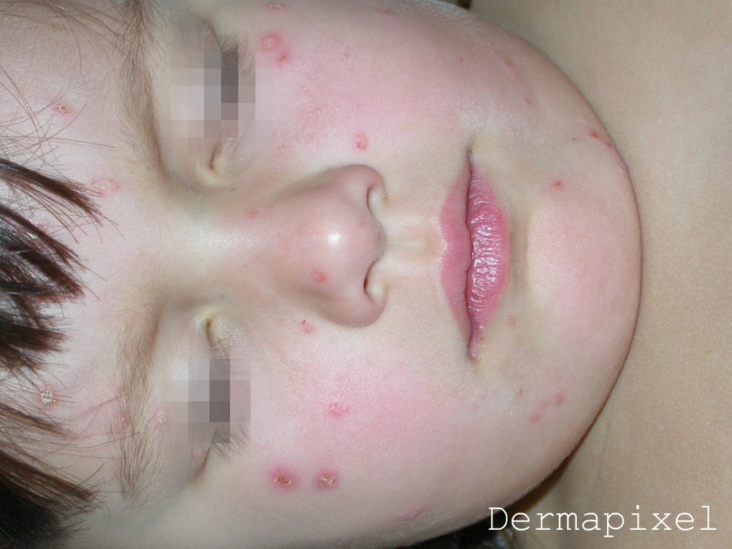 Dermapixel: mayo 2013