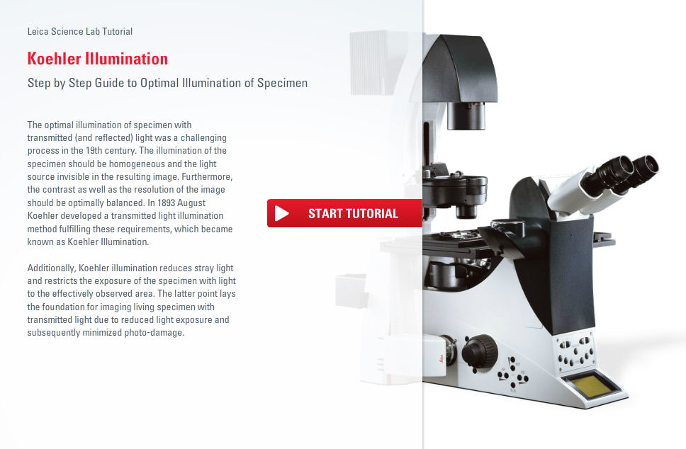 Medical Laboratory and Biomedical Science: Microscope Koehler ...