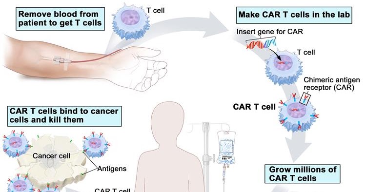 Colgate Virology (and Immunology) Blog: "Armored" CAR T- Cells: A More Effective Form of ...