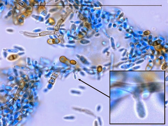 Fun With Microbiology (What's Buggin' You?): Hortaea werneckii