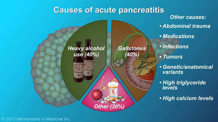 Diseases and patient care: Pancreatitis and treatment
