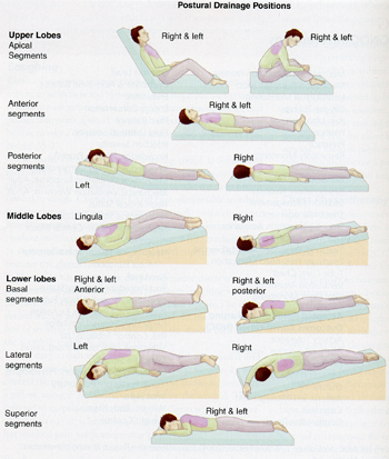 SAP Postural Drainages | DUNIA KEPERAWATAN