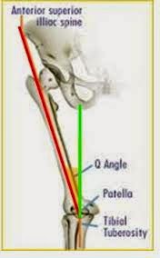 Kinebioactiva: Runner knee o rodilla del corredor, sindrome de la banda ...