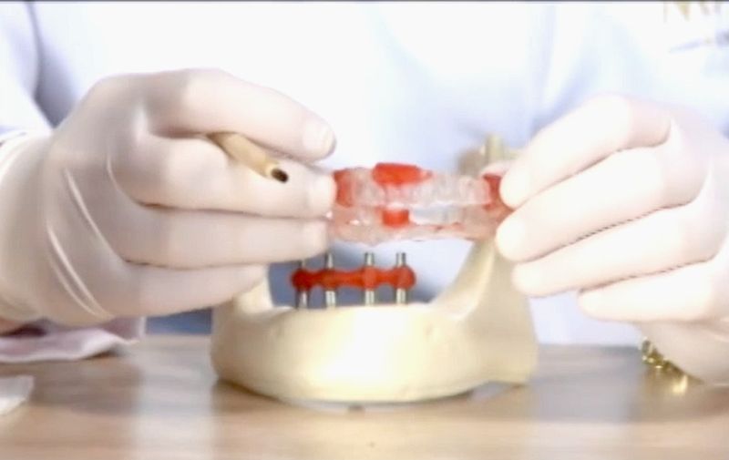 IMPLANTODONTIA: Hands On em manequim da moldagem para protocolo ...