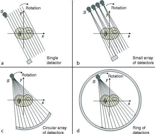 Computed Tomography: Evolution of CT Scan