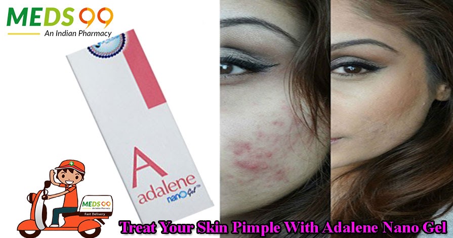 Get Complete Treatment of All the Acne Issues with Adalene Nano Gel