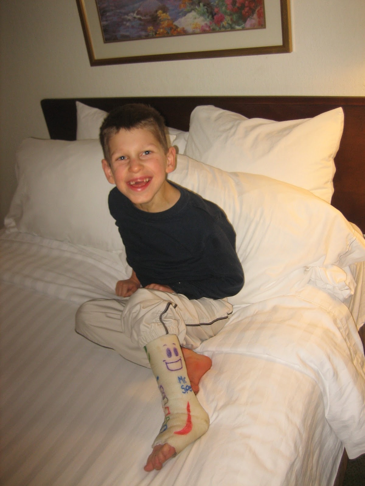 Kevin's Healing Journey: Left Foot Cast #2