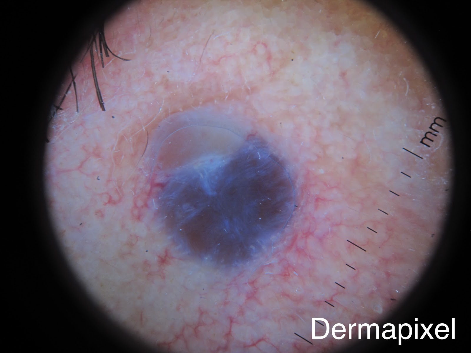 Dermapixel: mayo 2018