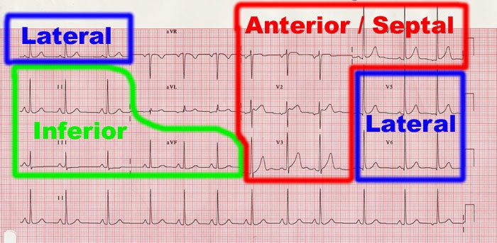 Medical Student Life: Cara Baca Ecg