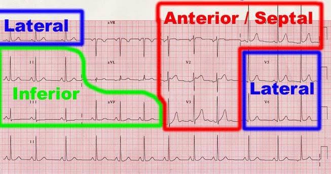 Medical Student Life: Cara Baca Ecg