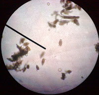 HISTOLOGY ATLAS 3D FOR MEDICAL STUDENTS.: SCHISTOMIASIS (S.JAPONICUM, S ...