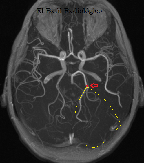 El Baúl Radiológico: POCI: DISTRIBUCIÓN TERRITORIAL. HALLAZGOS EN ...