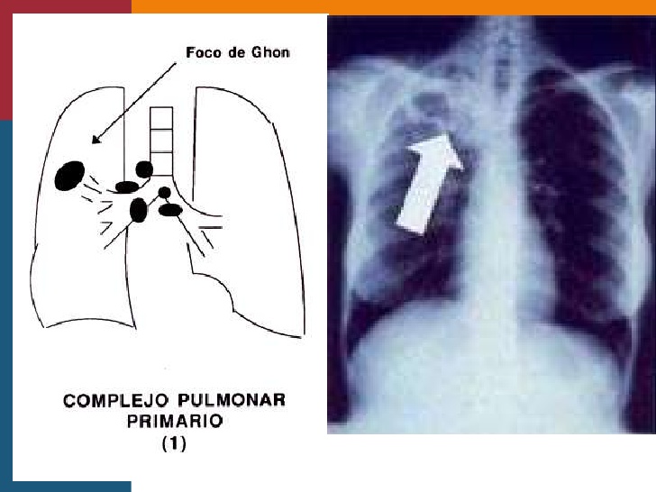 Bacterias Actuaciencia: abril 2018