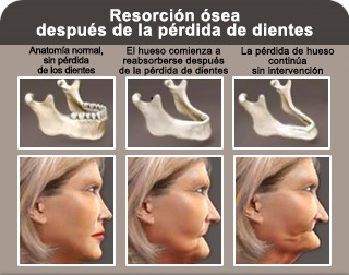 DOC OSCAR MARTINEZ: CARACTERÍSTICAS GENERALES DE LOS PACIENTES ...