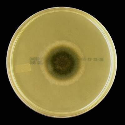 Fun With Microbiology (What's Buggin' You?): Exserohilum rostratum