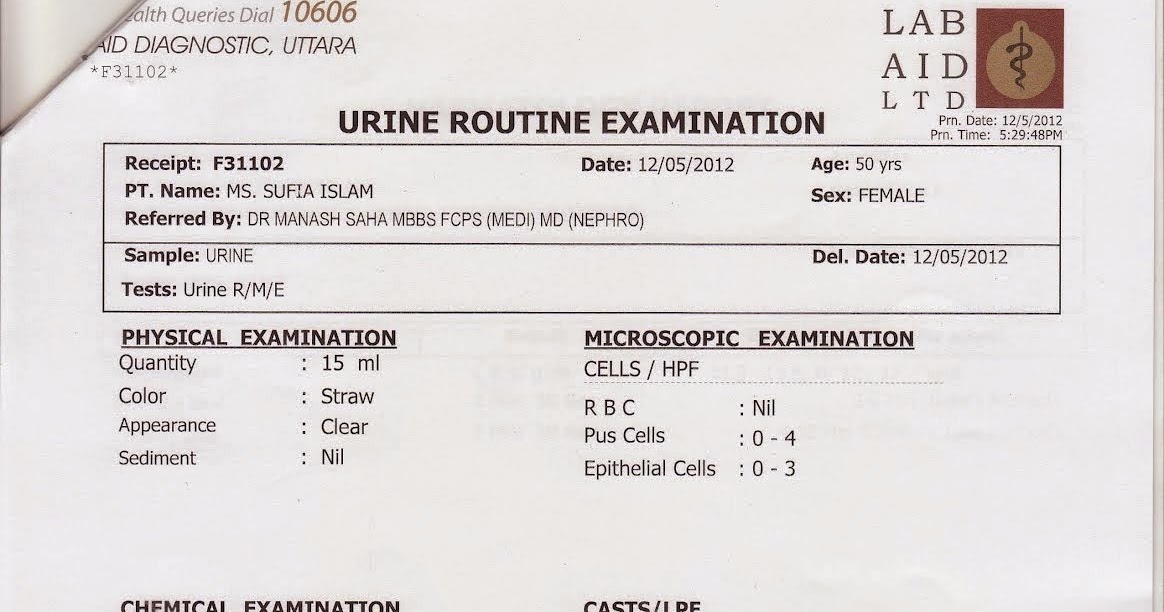 Pharma Rocks EVERYTIME: urine test reports rate are here my friends