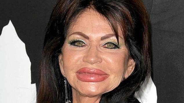 LO NUEVO DE LA RED: Las mujeres más operadas de Hollywood (+Fotos)