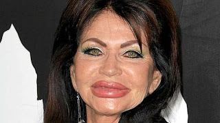 LO NUEVO DE LA RED: Las mujeres más operadas de Hollywood (+Fotos)