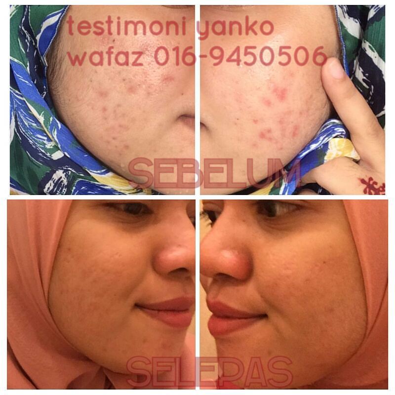 Natural Health Be Young: TESTIMONI YANKO SKINCARE