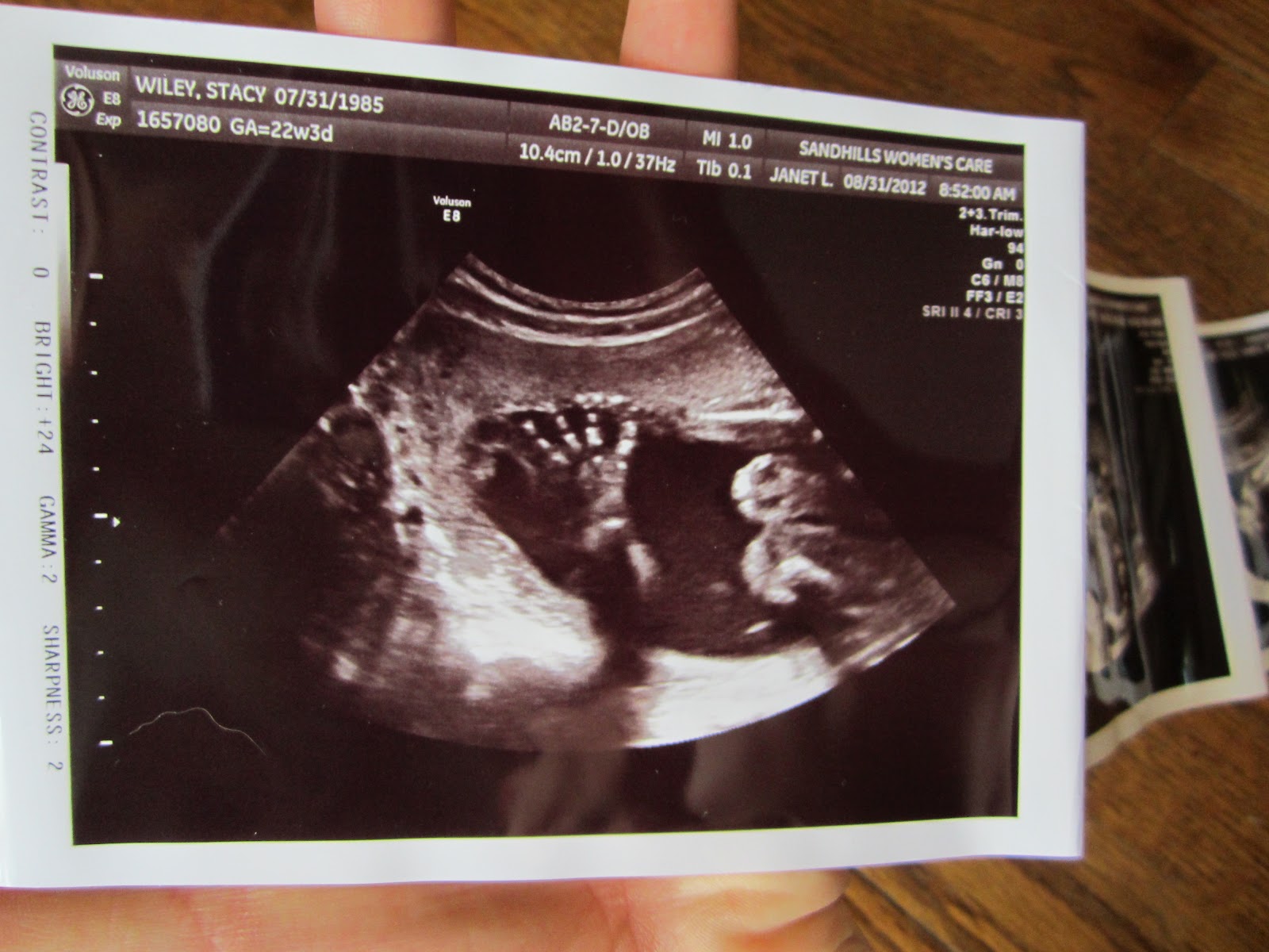 The Wiley Family: 21 Week Ultrasound