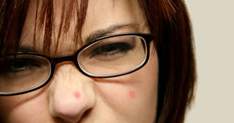 Cara Menghilangkan Bekas Bisul Dan Flek Hitam Secara Alami - Jerawat