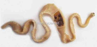 HISTOLOGY ATLAS 3D FOR MEDICAL STUDENTS.: PARASITOLOGY MICROSCOPIC ...