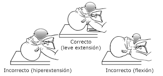 GUIAS DE MEDICINA : REANIMACION NEONATAL