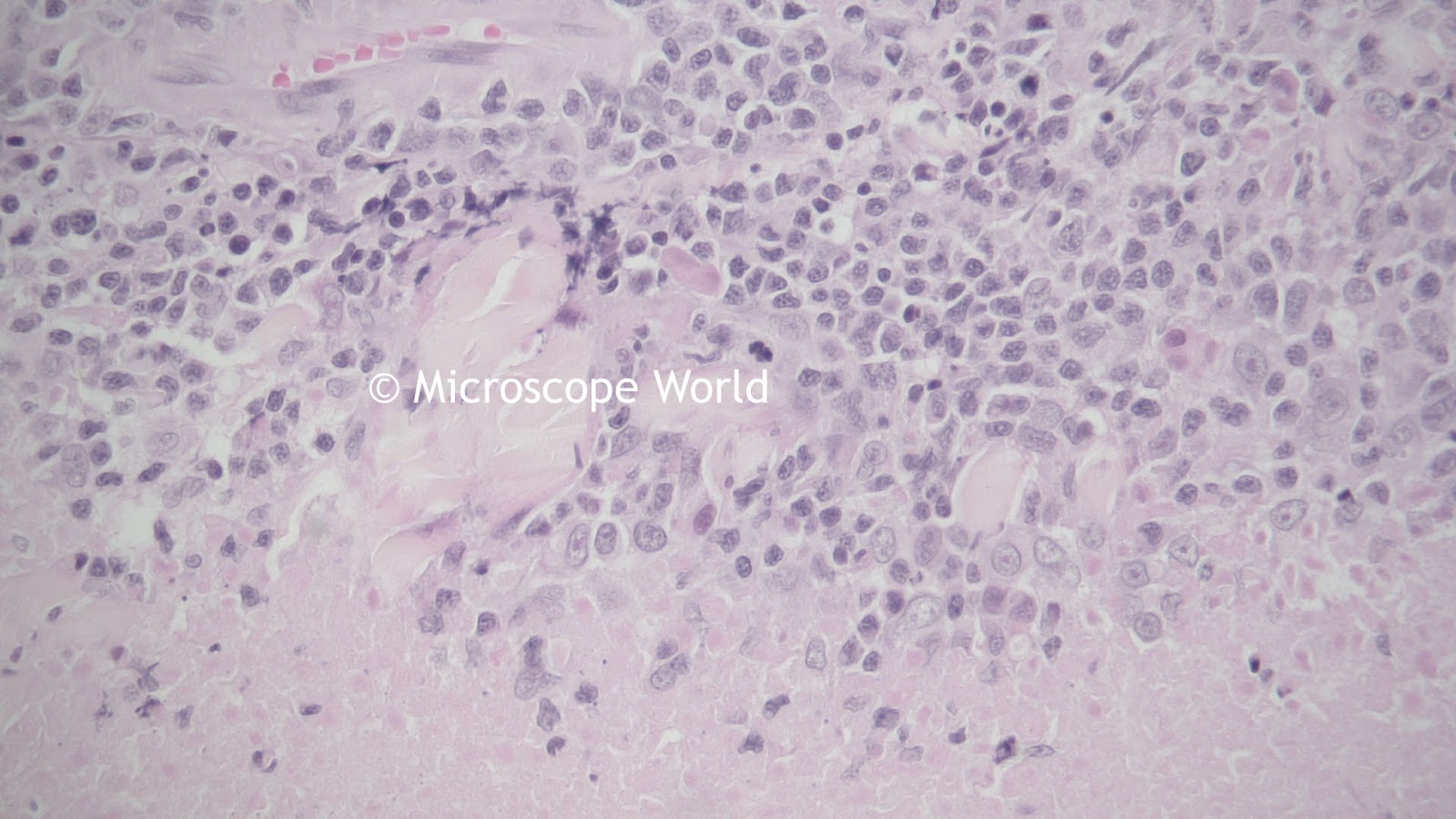 Microscope World Blog: Tissue captured with HD Camera under Microscope
