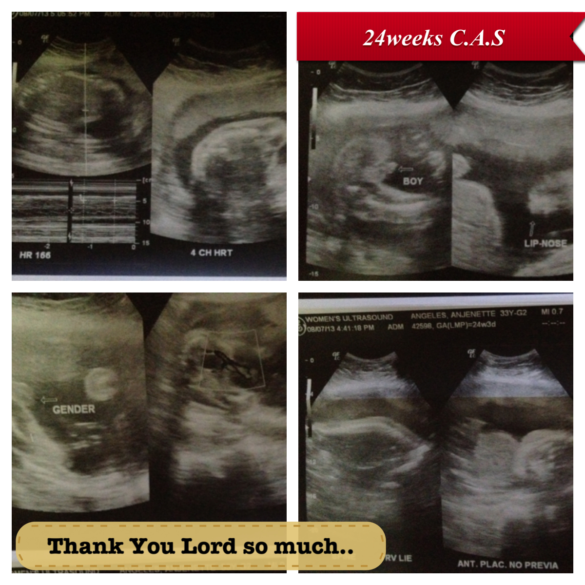 OUR INFERTILITY BATTLE: Congenital.Anomaly.Scan at 24weeks