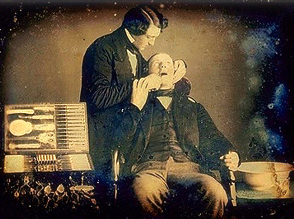 When Tooth Extraction Is Terrifying: 32 Scary Photos Show the Early ...