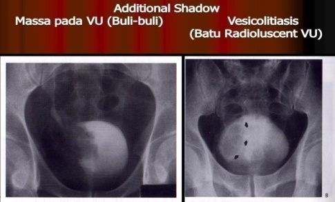 Laporan Pendahuluan, Asuhan Keperawatan, DOPS, SAP, SOP, Pendidikan ...