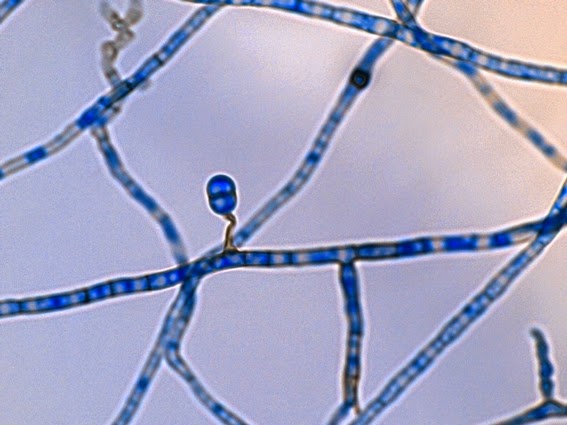 Fun With Microbiology (What's Buggin' You?): Ochroconis species